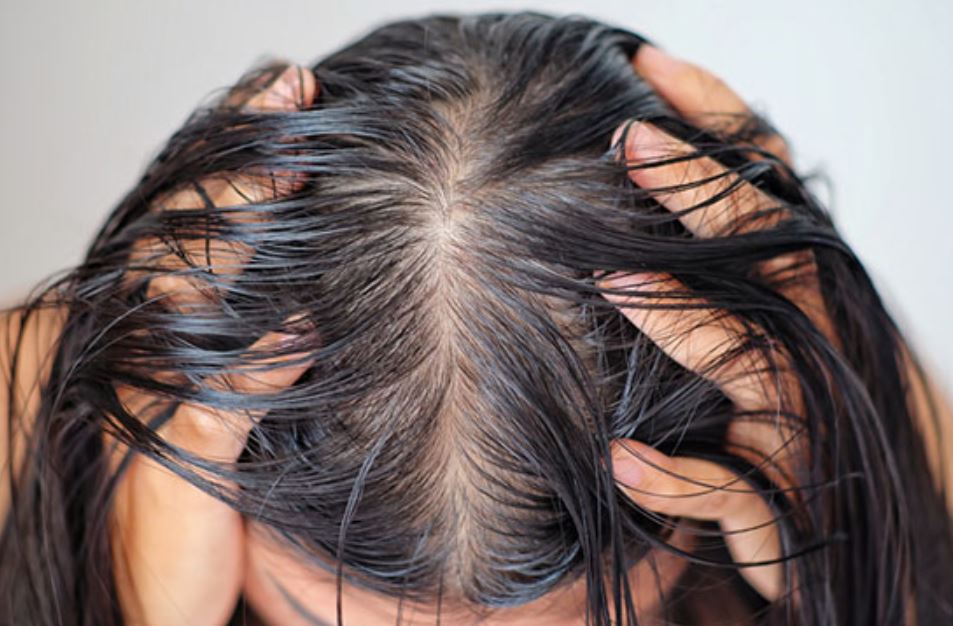 Ways To Deal With An Oily Scalp Ziering Medical Ways To Deal With An Oily Scalp Ziering Medical